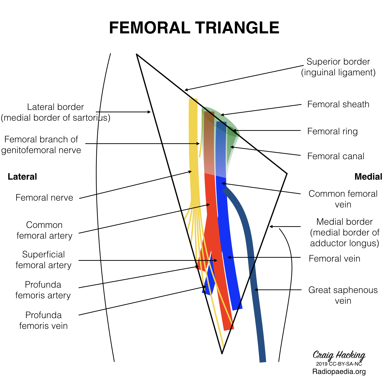 Radiopaedia - Drawing Femoral triangle schematic - English labels | AnatomyTOOL